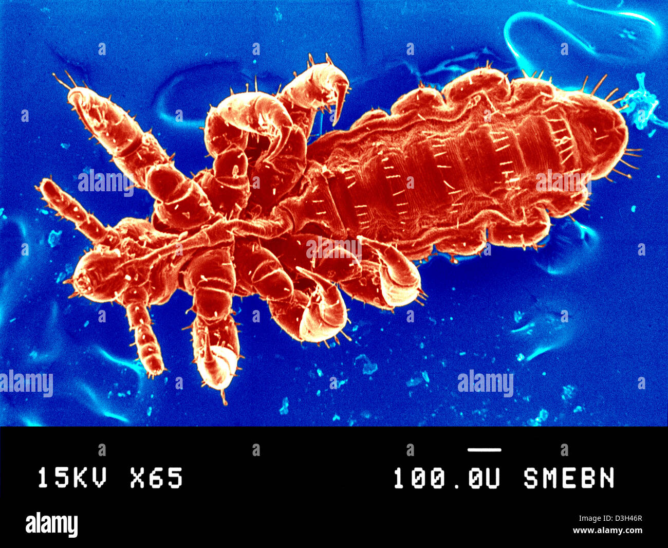 HUMAN HEAD LOUSE, SEM Stock Photo - Alamy