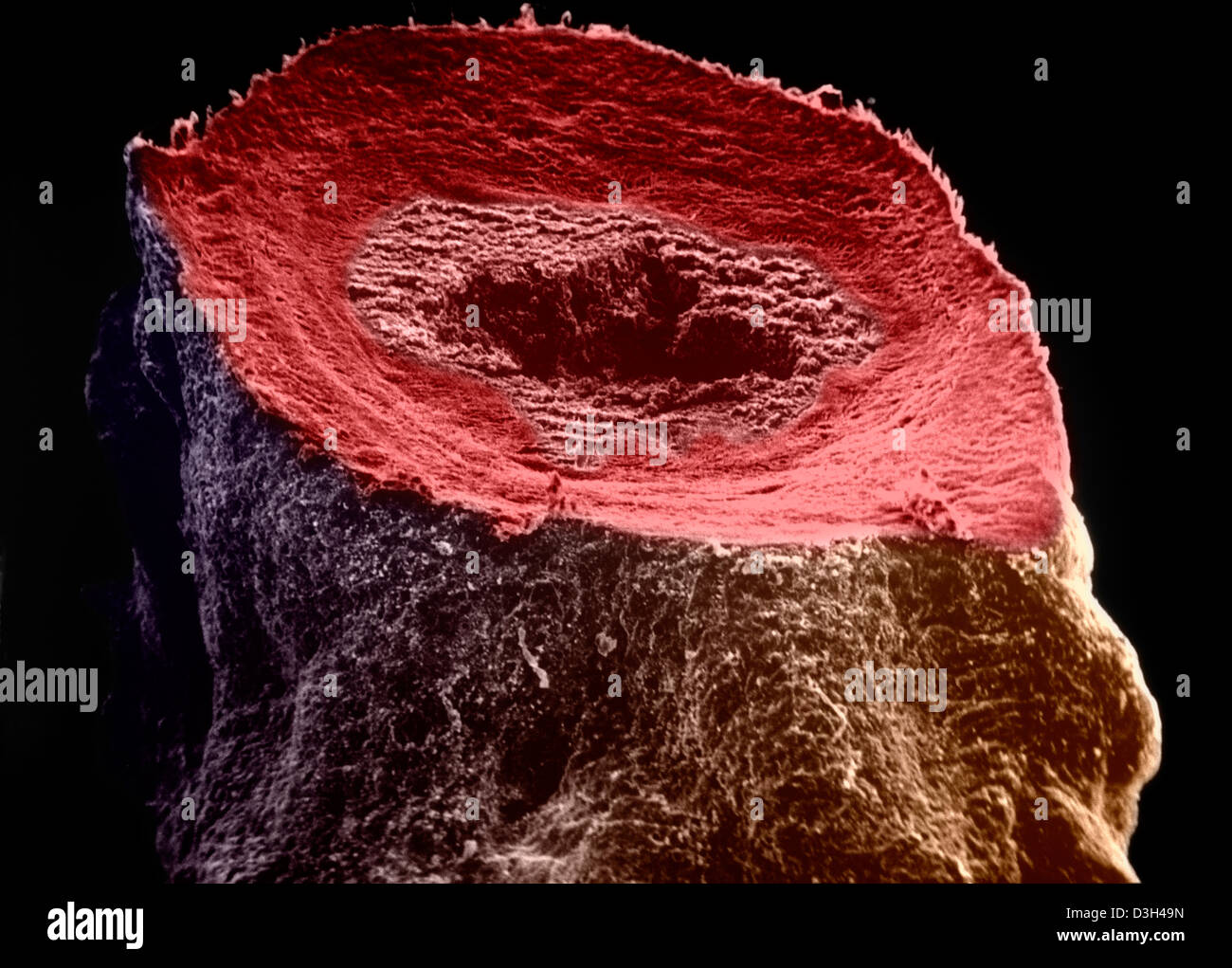 Electron microscopy vein hi-res stock photography and images - Alamy