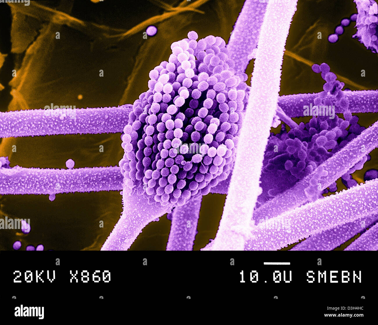 Aspergillus fungus sem hi-res stock photography and images - Alamy