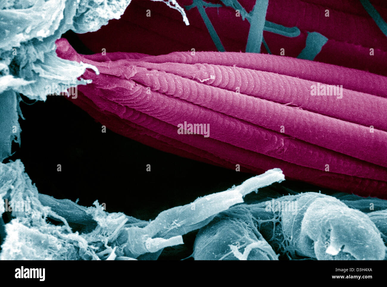 Muscle fibers micrograph hi-res stock photography and images - Alamy