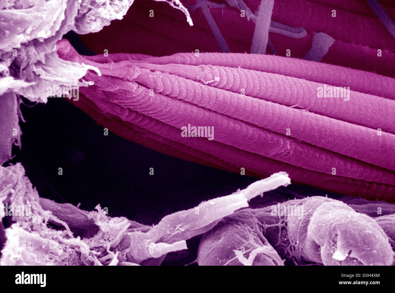 Muscle fiber micrograph hi-res stock photography and images - Alamy