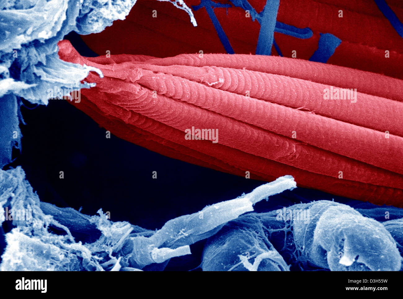 Muscle fibers micrograph hi-res stock photography and images - Alamy