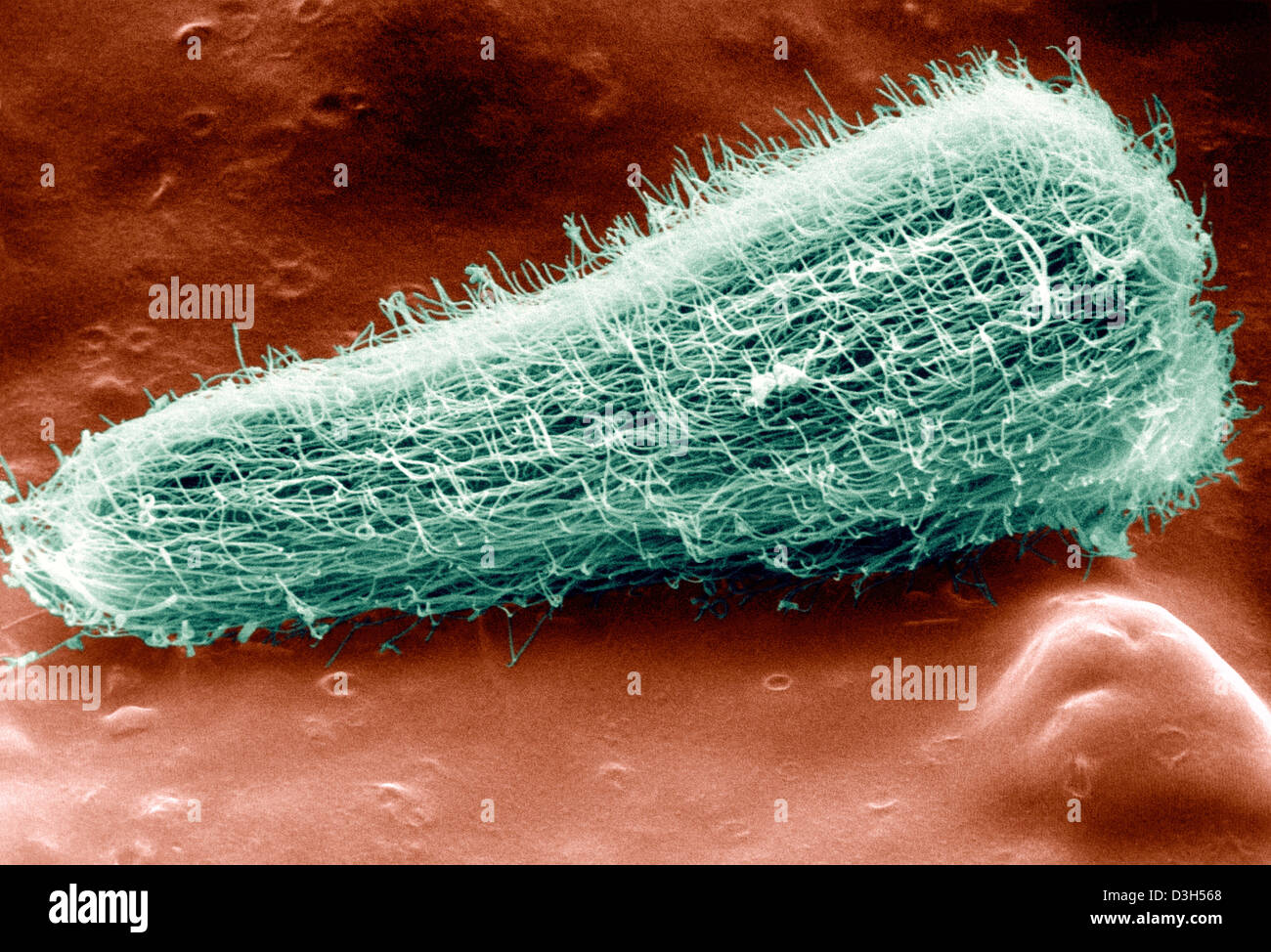 SHEEP LIVER FLUKE LARVA Stock Photo - Alamy