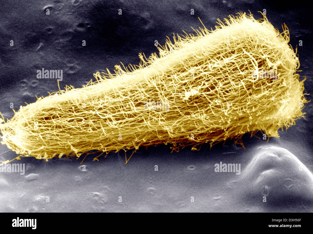 Sheep liver fluke fasciola hepatica hi-res stock photography and images ...