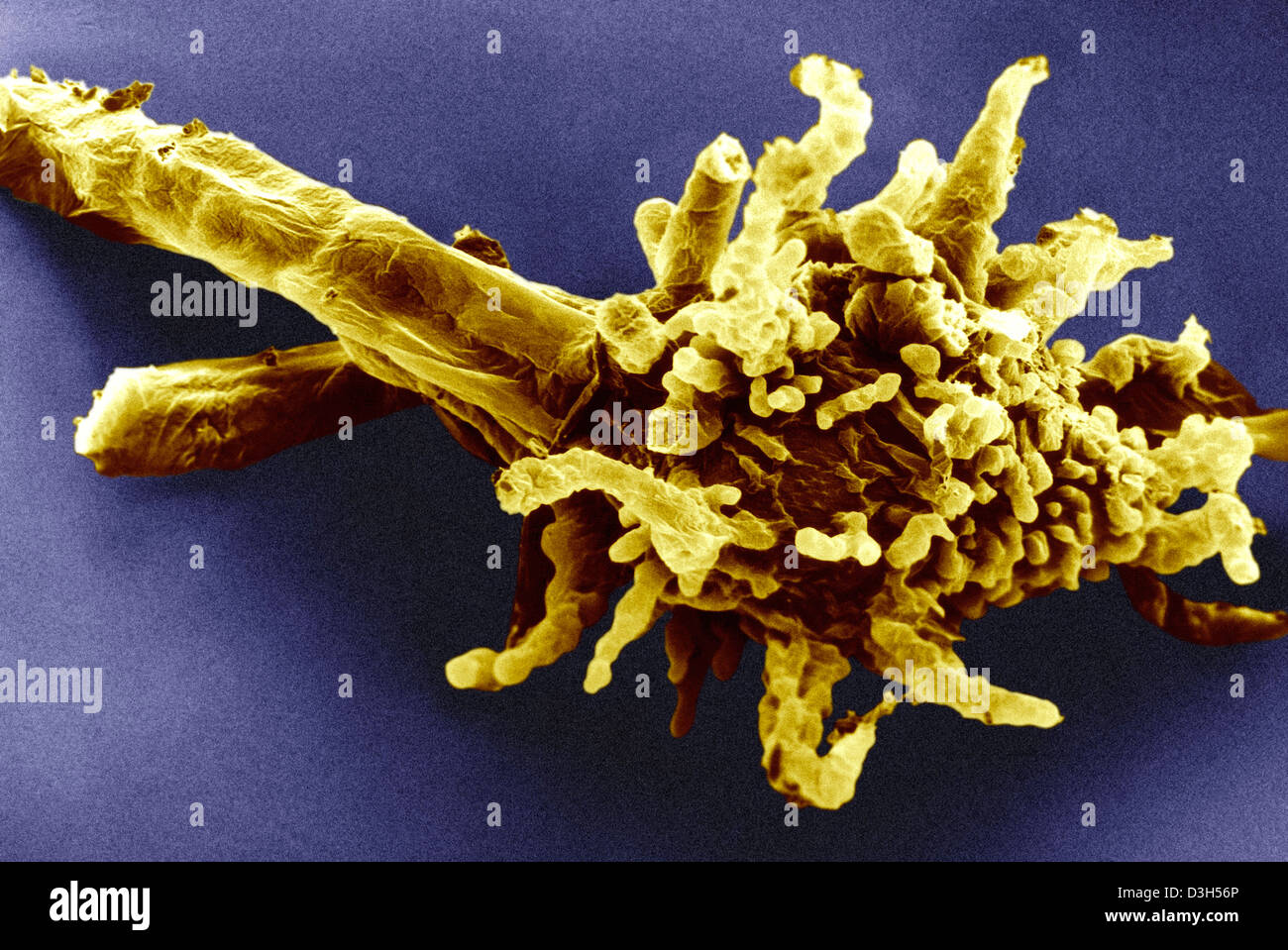 Amoeba proteus electron microscope hi-res stock photography and images ...