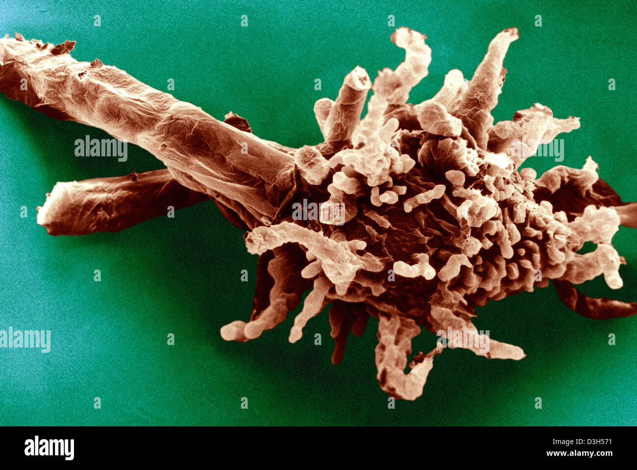 Amoeba micrograph hi-res stock photography and images - Alamy