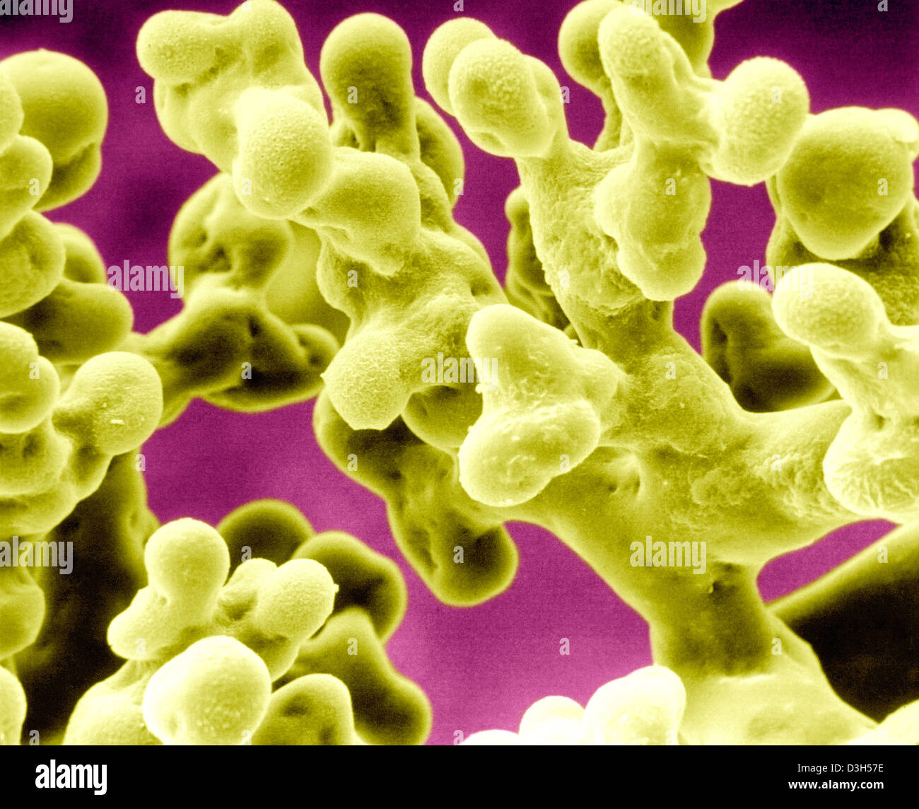 Micrograph lung alveoli alveolar hi-res stock photography and images ...