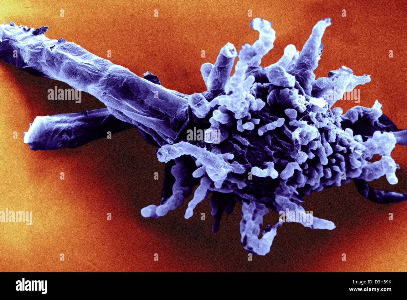 Amoeba In The Human Body