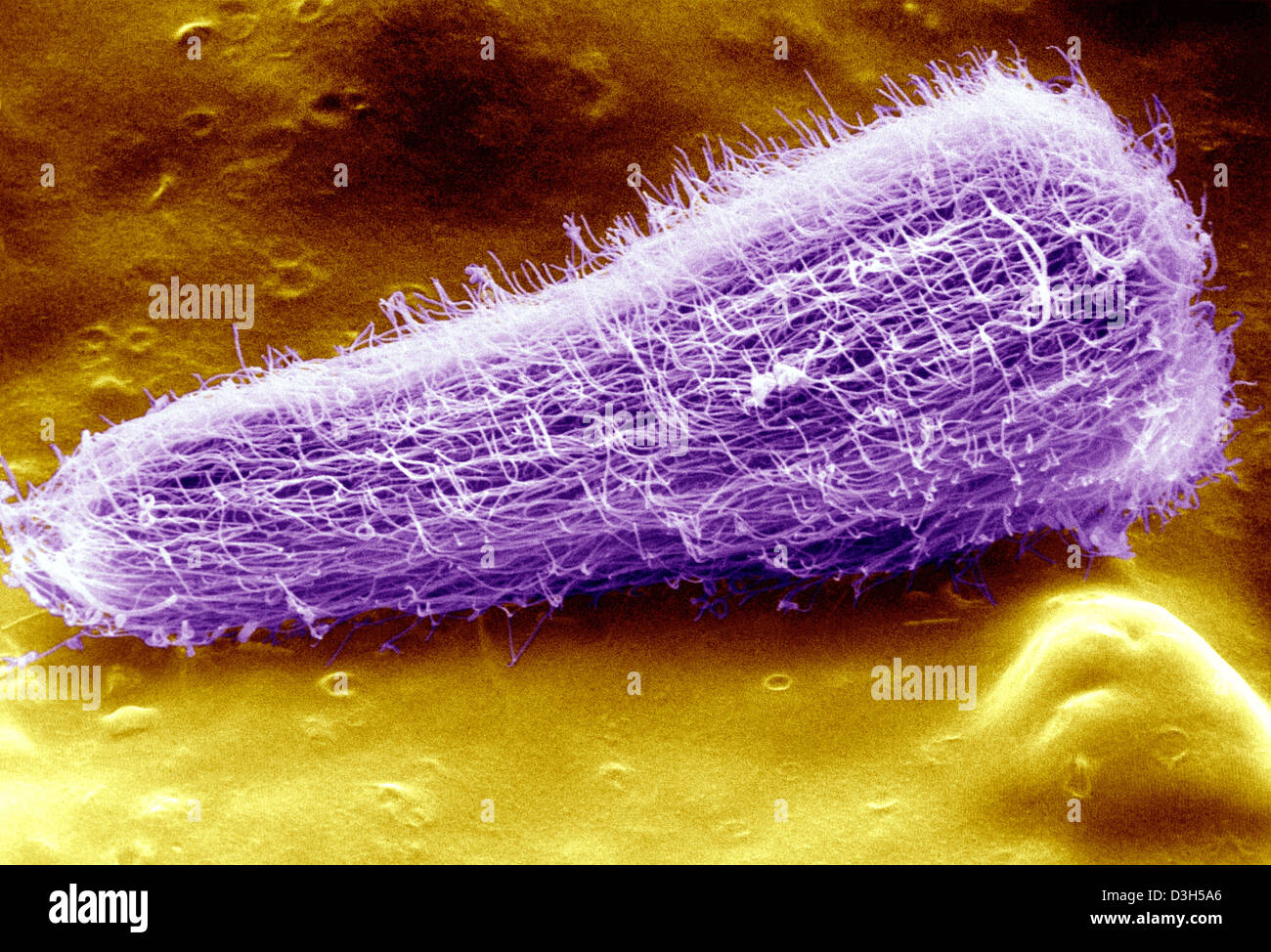 Liver fluke micrograph hi-res stock photography and images - Alamy