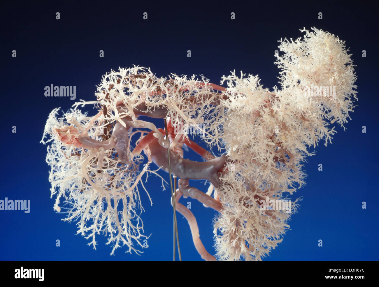 Renal tubes hi-res stock photography and images - Alamy