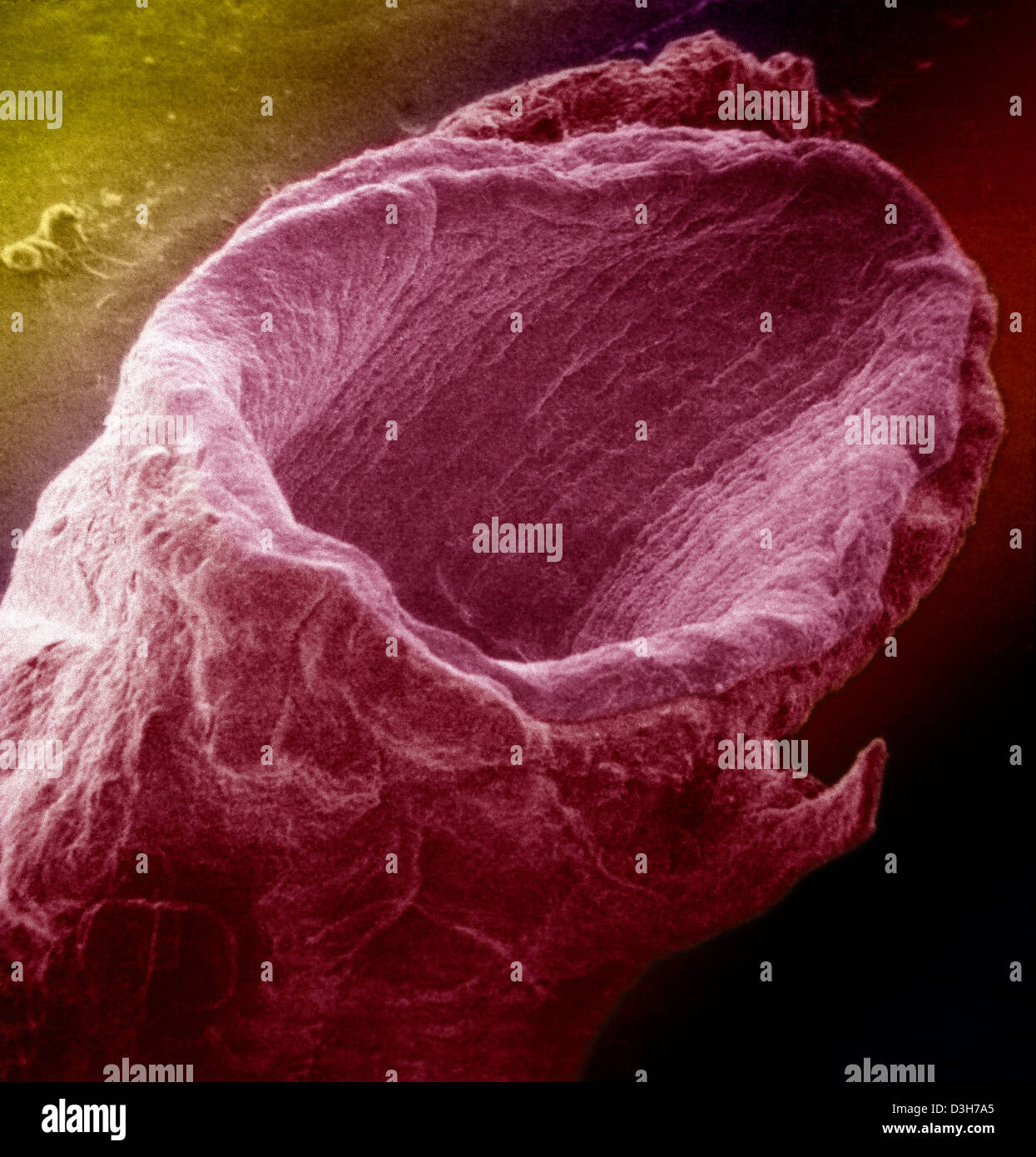 Electron microscopy vein hi-res stock photography and images - Alamy