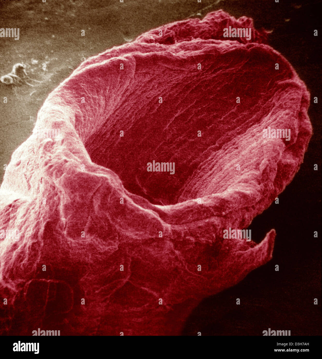 Blood vessels sem hi-res stock photography and images - Alamy