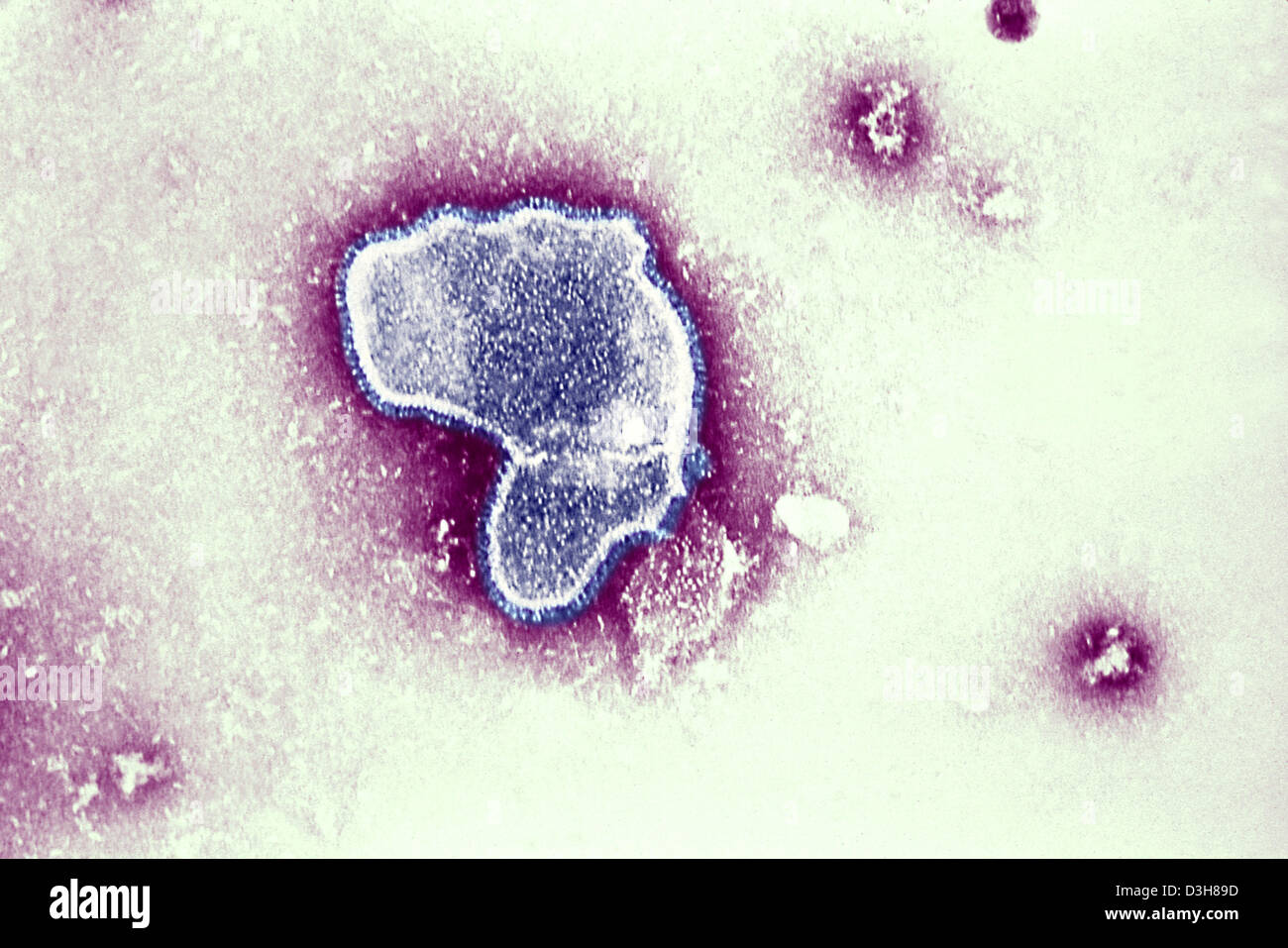 Respiratory syncytial virus hi-res stock photography and images - Alamy