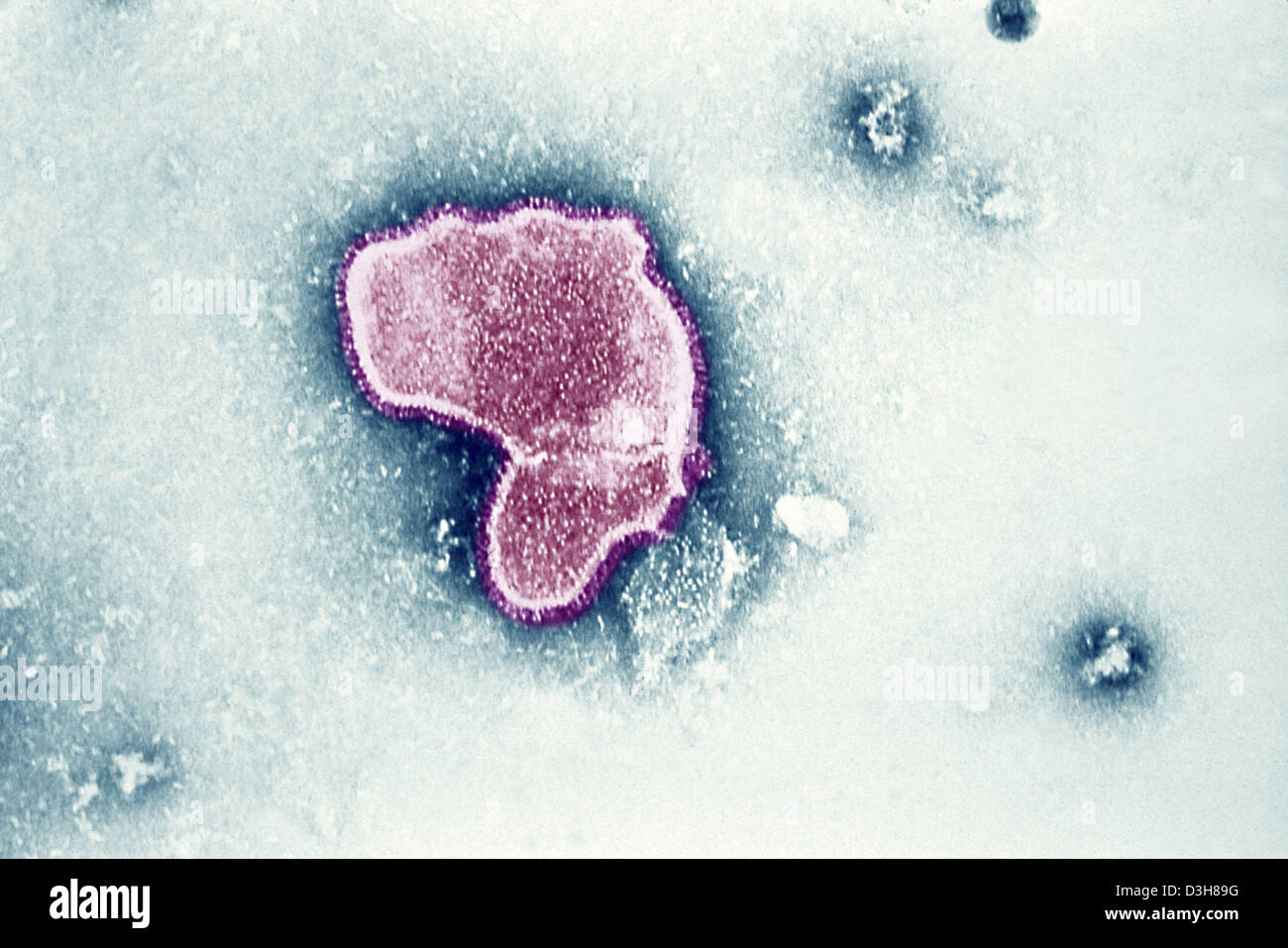 RESPIRATORY SYNCYTIAL VIRUS Stock Photo - Alamy