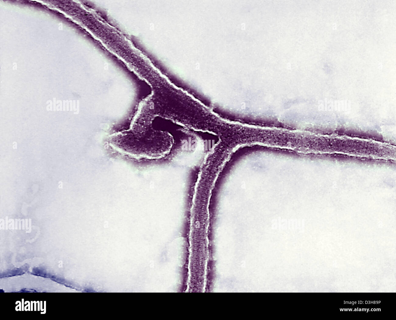 Marburg disease hi-res stock photography and images - Alamy