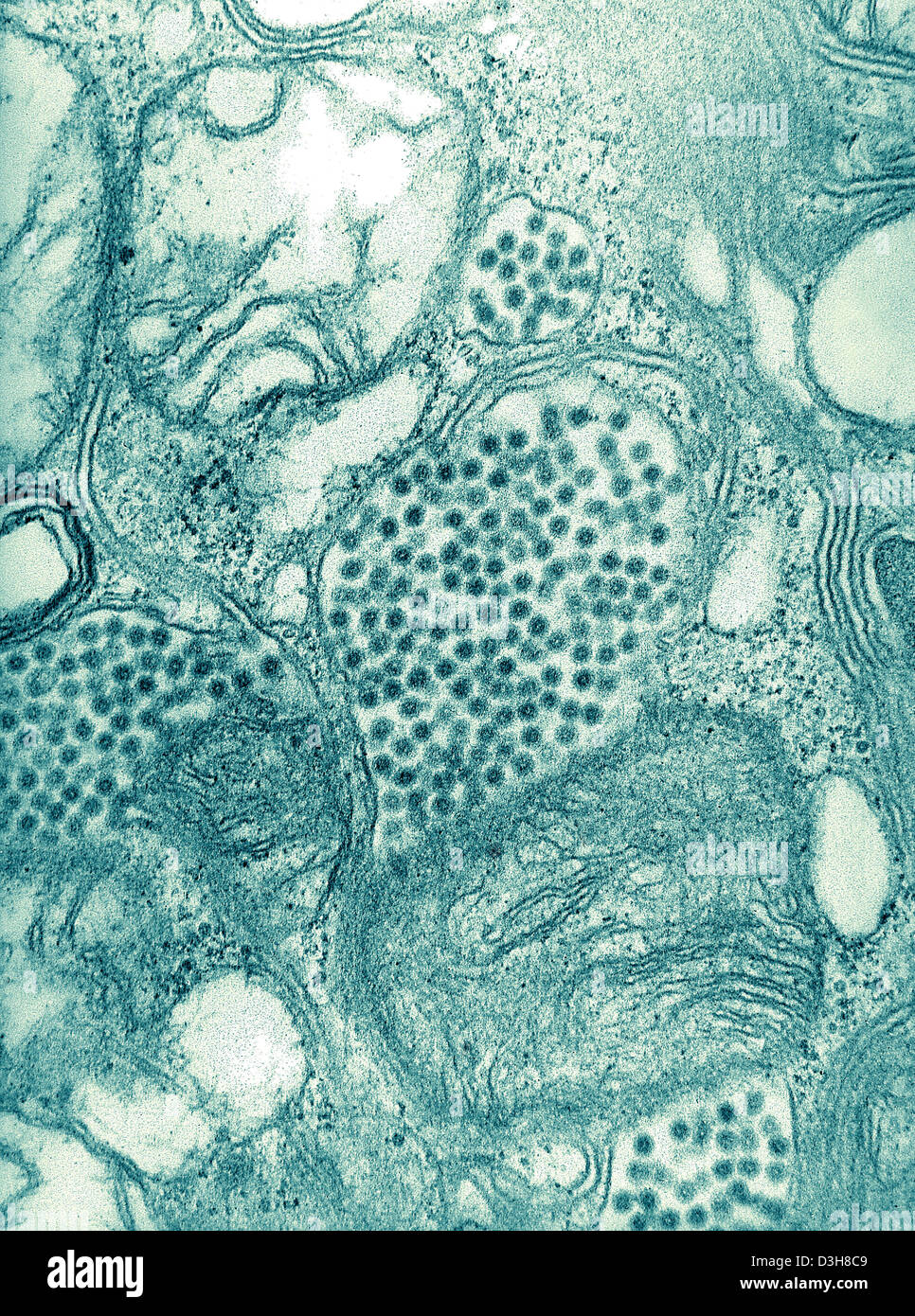 Eastern equine encephalitis hi-res stock photography and images - Alamy