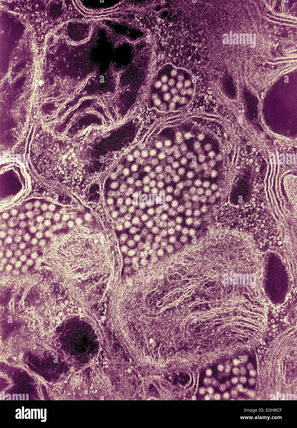 Eastern equine encephalitis virus hi-res stock photography and images ...