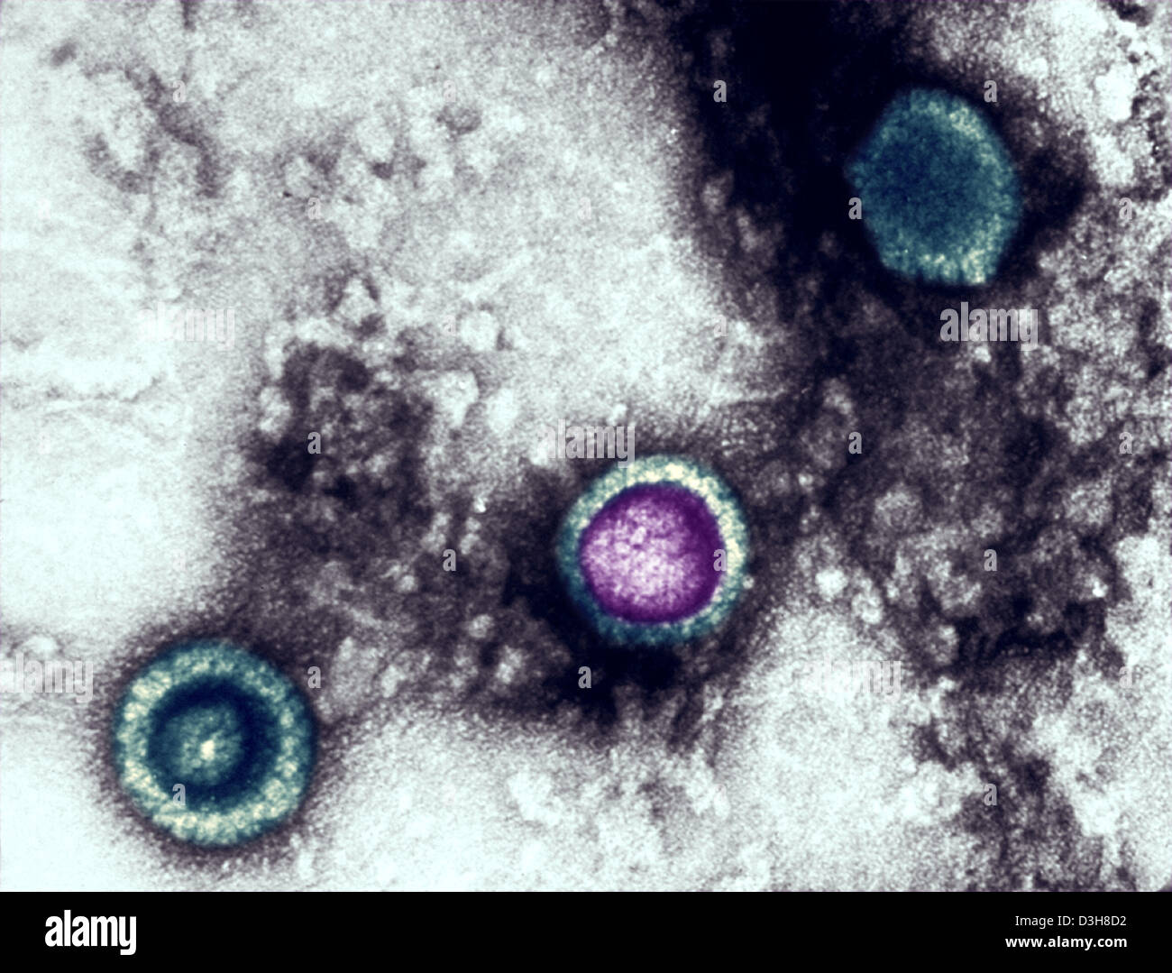 Herpes simplex virions hi-res stock photography and images - Alamy