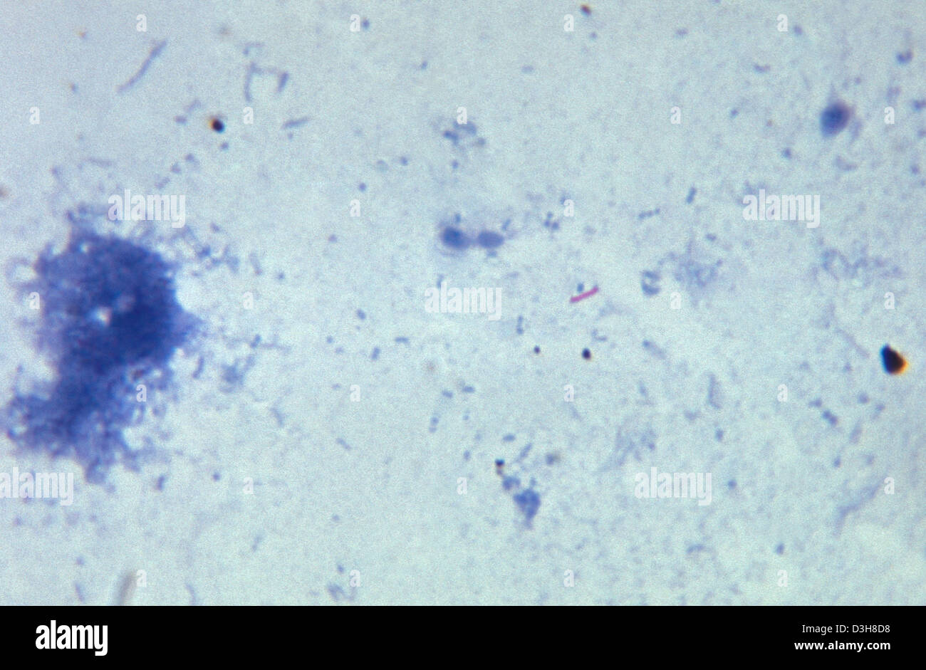 Mycobacterium tuberculosis smear hi-res stock photography and images - Alamy