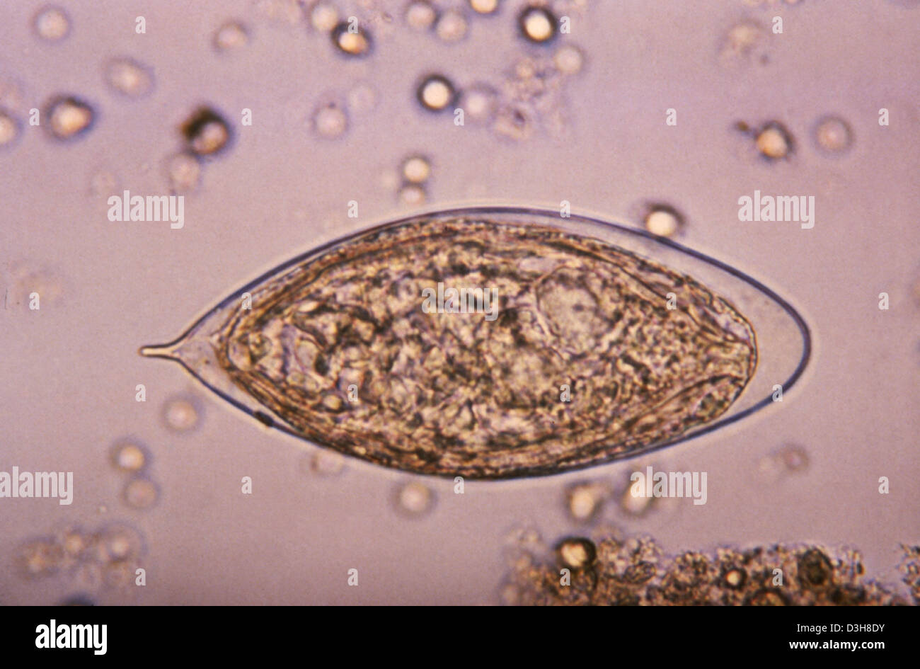 Schistosoma High Resolution Stock Photography and Images - Alamy