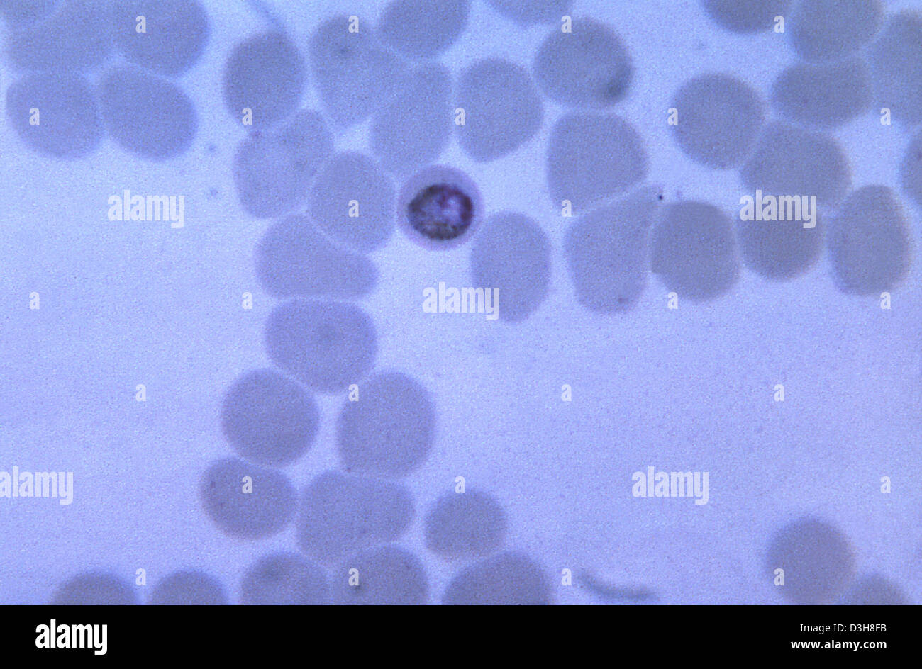 Plasmodium micrograph hi-res stock photography and images - Alamy