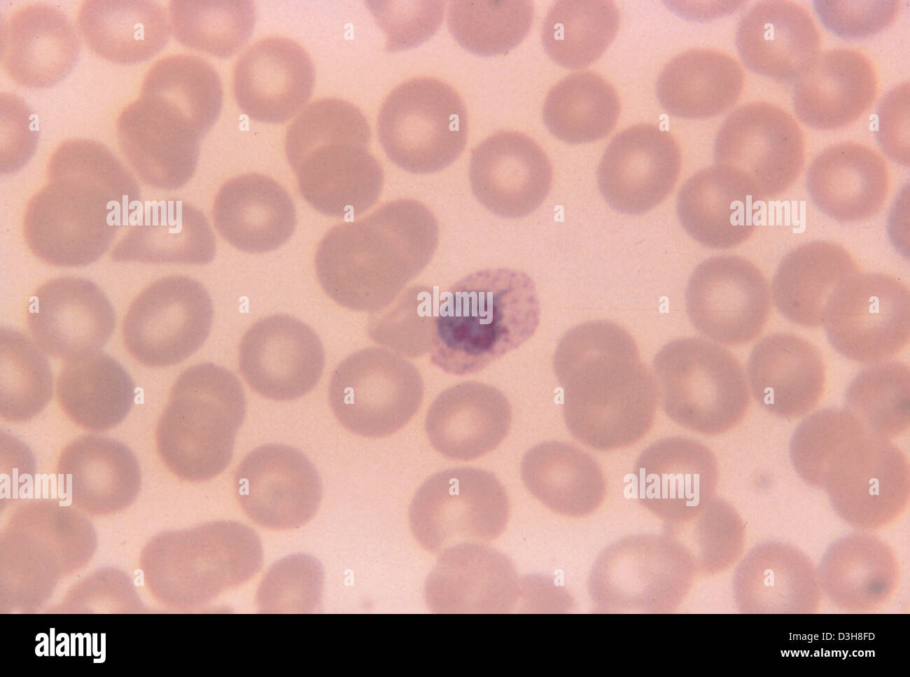 Plasmodium Blood Cell High Resolution Stock Photography and Images - Alamy