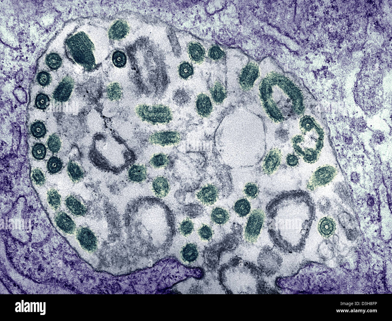 Marburg disease hi-res stock photography and images - Alamy