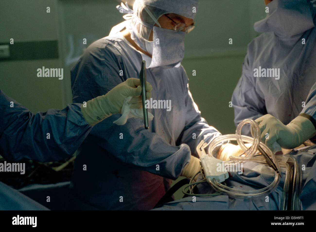 HIP PROSTHESIS, SURGERY Stock Photo - Alamy