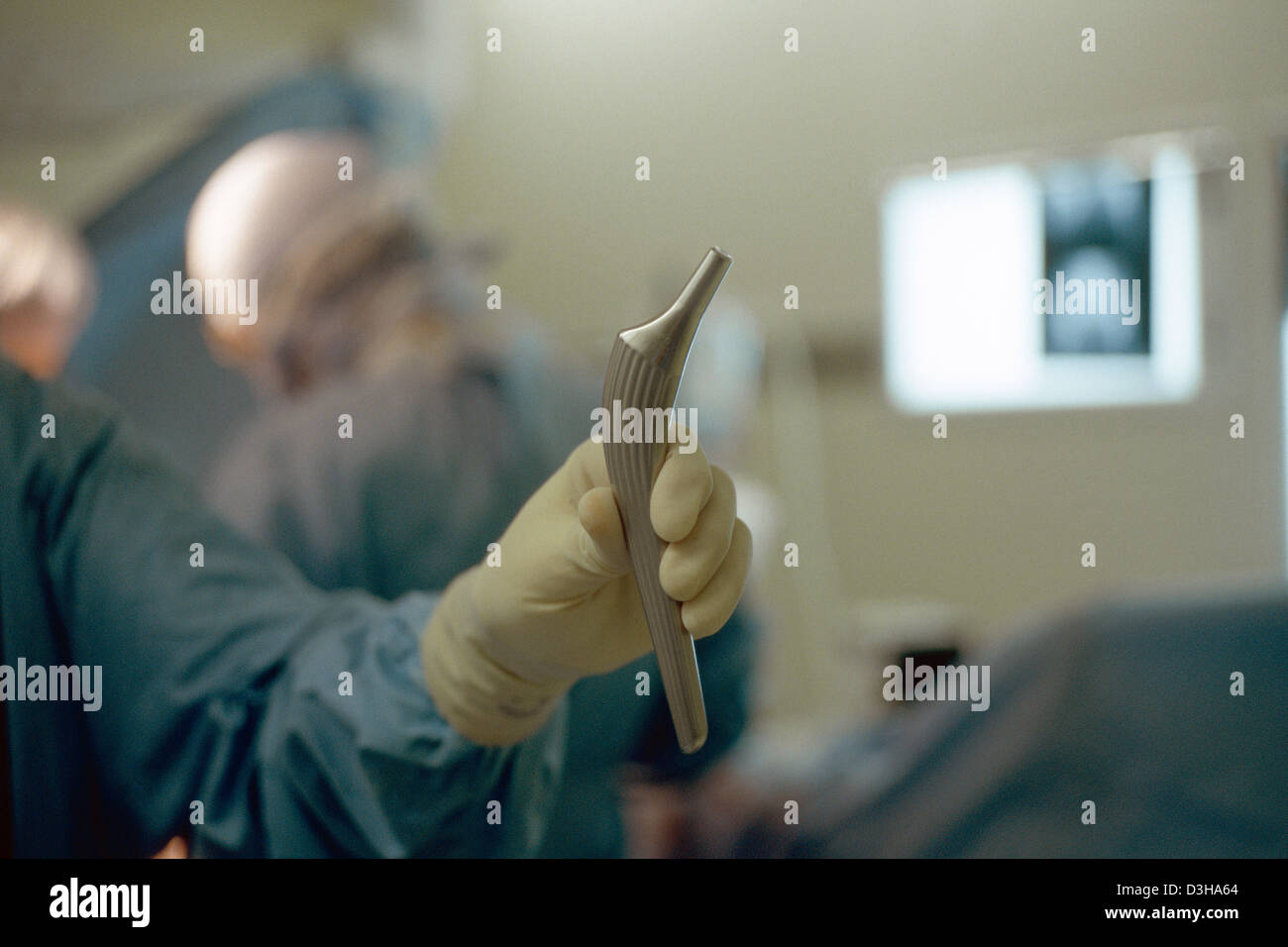 HIP PROSTHESIS, SURGERY Stock Photo - Alamy