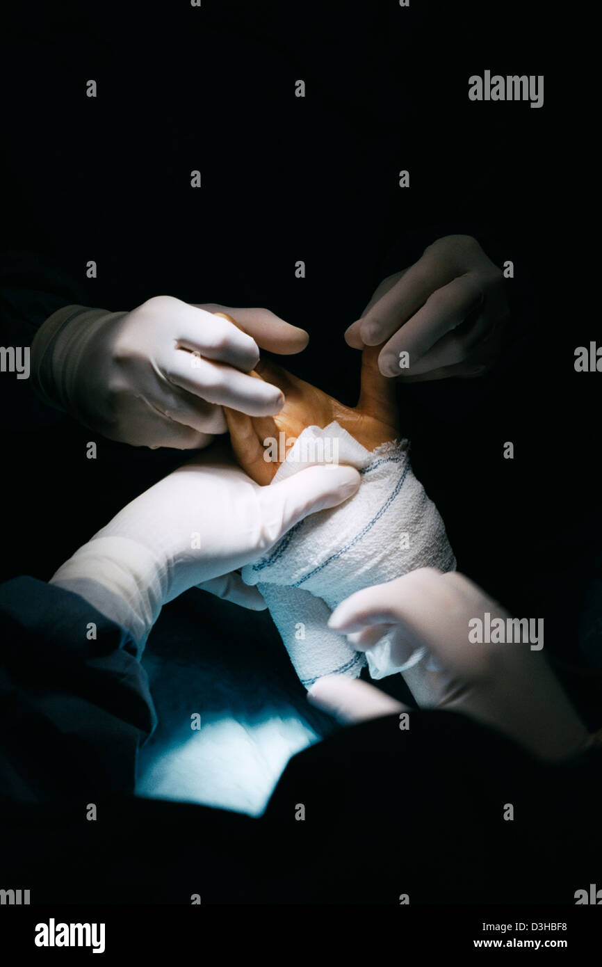 Hand and upper limb surgery hi-res stock photography and images - Alamy