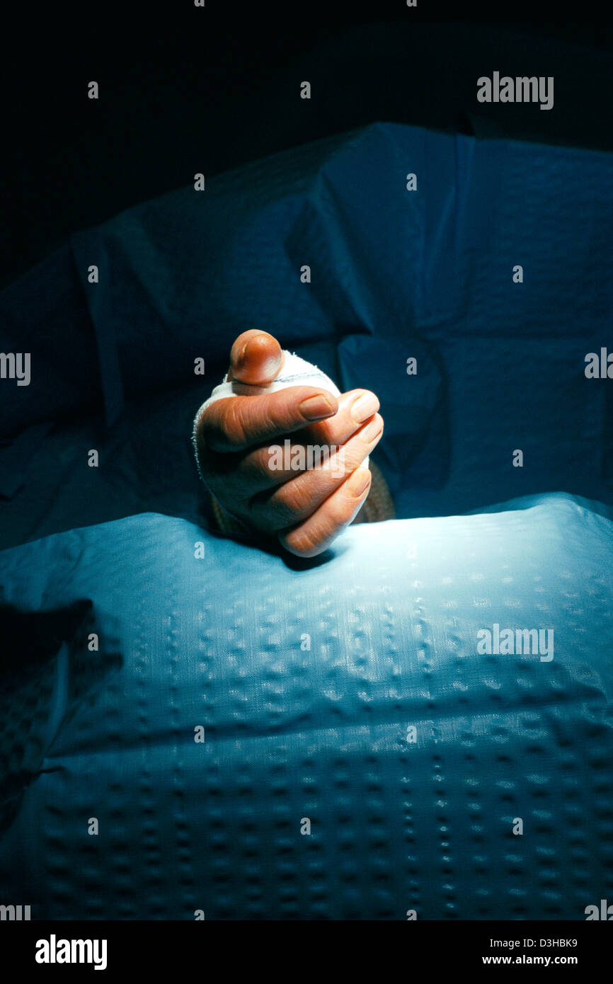 Hand and upper limb surgery hi-res stock photography and images - Alamy