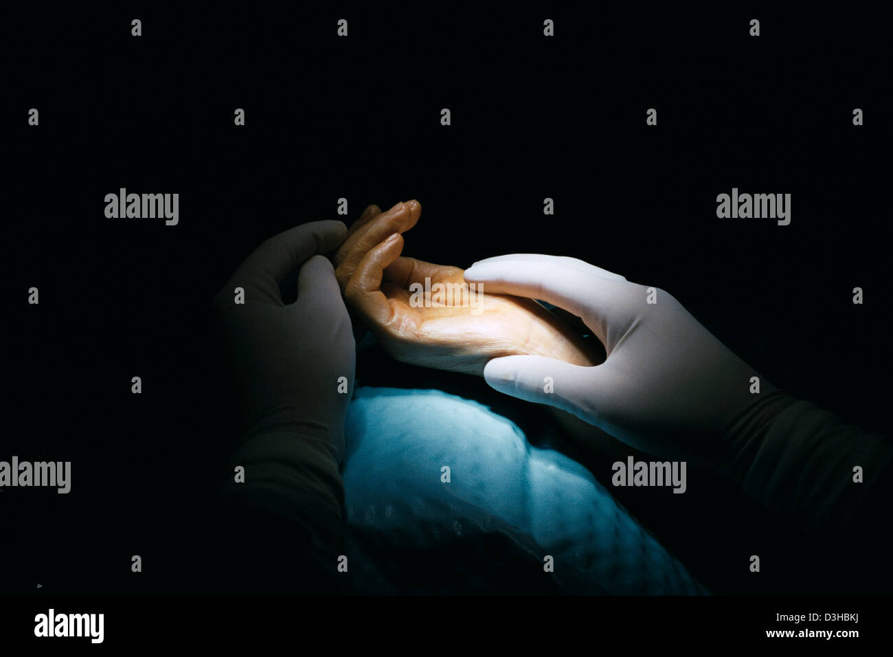 Hand and upper limb surgery hi-res stock photography and images - Alamy
