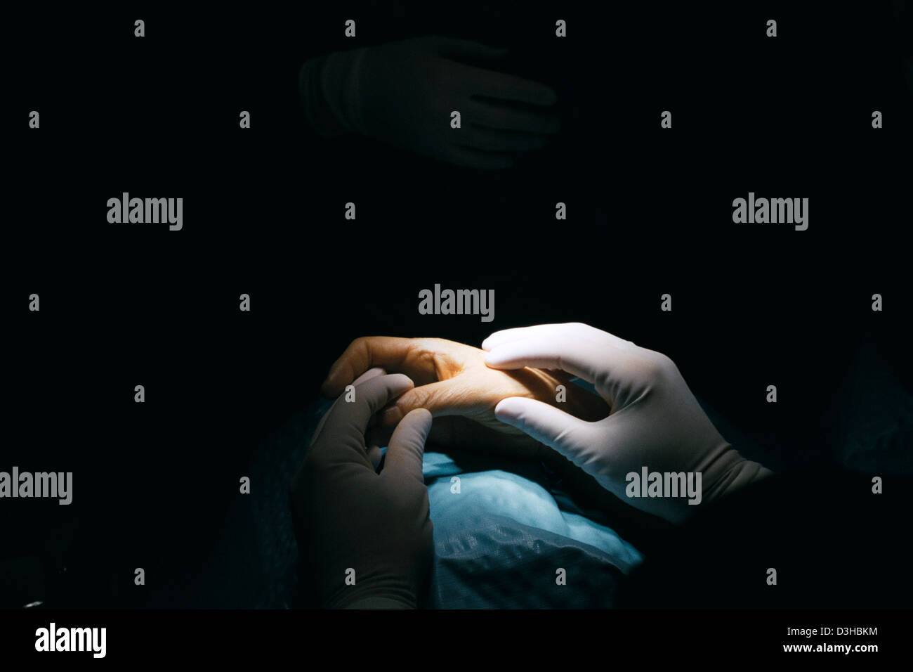 Hand and upper limb surgery hi-res stock photography and images - Alamy