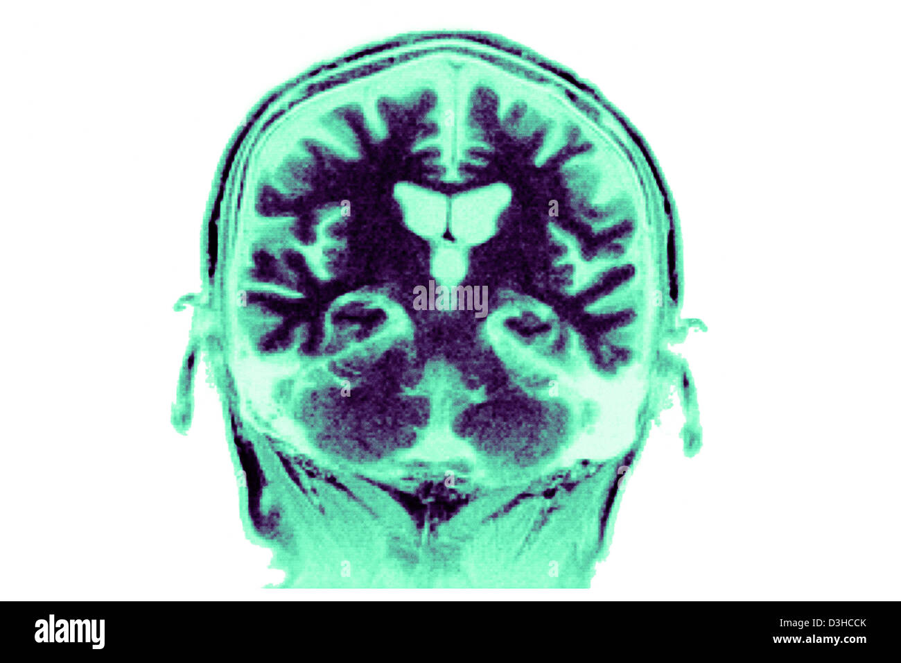 Memory techniques hi-res stock photography and images - Alamy