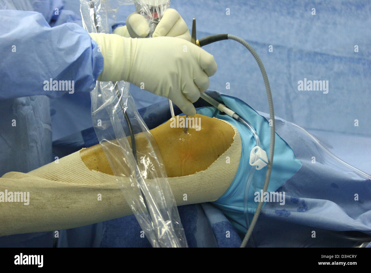 Arthroscopy instrument hi-res stock photography and images - Alamy