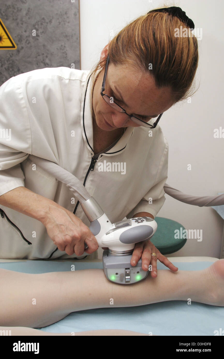 Cellulitis leg hi-res stock photography and images - Alamy