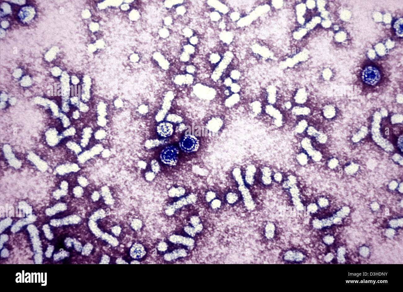 HEPATITIS B VIRUS Stock Photo - Alamy