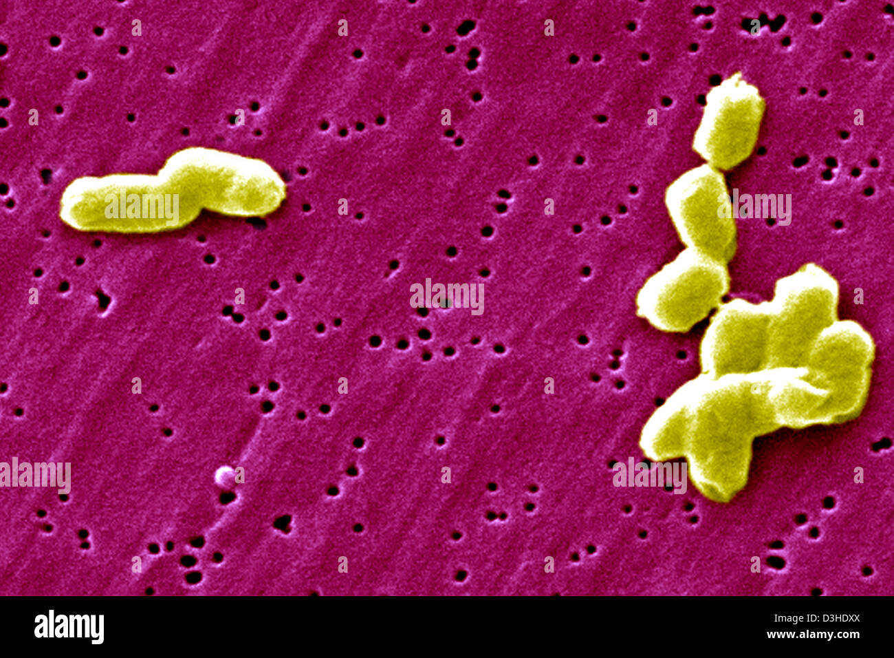 Salmonella sem hi-res stock photography and images - Alamy