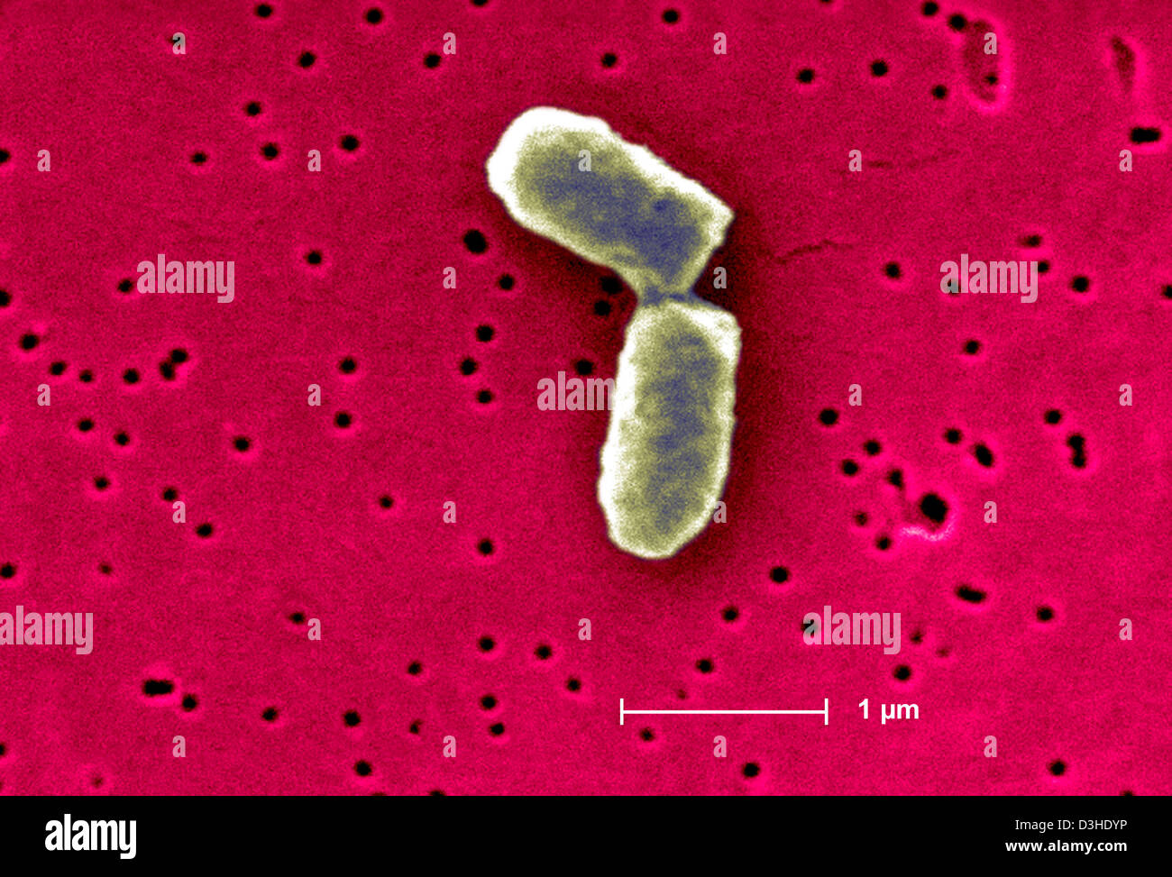 Escherichia coli electron micrograph hi-res stock photography and ...