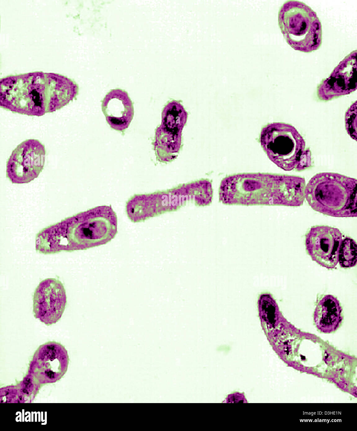 Bacillus anthracis micrograph hi-res stock photography and images - Alamy