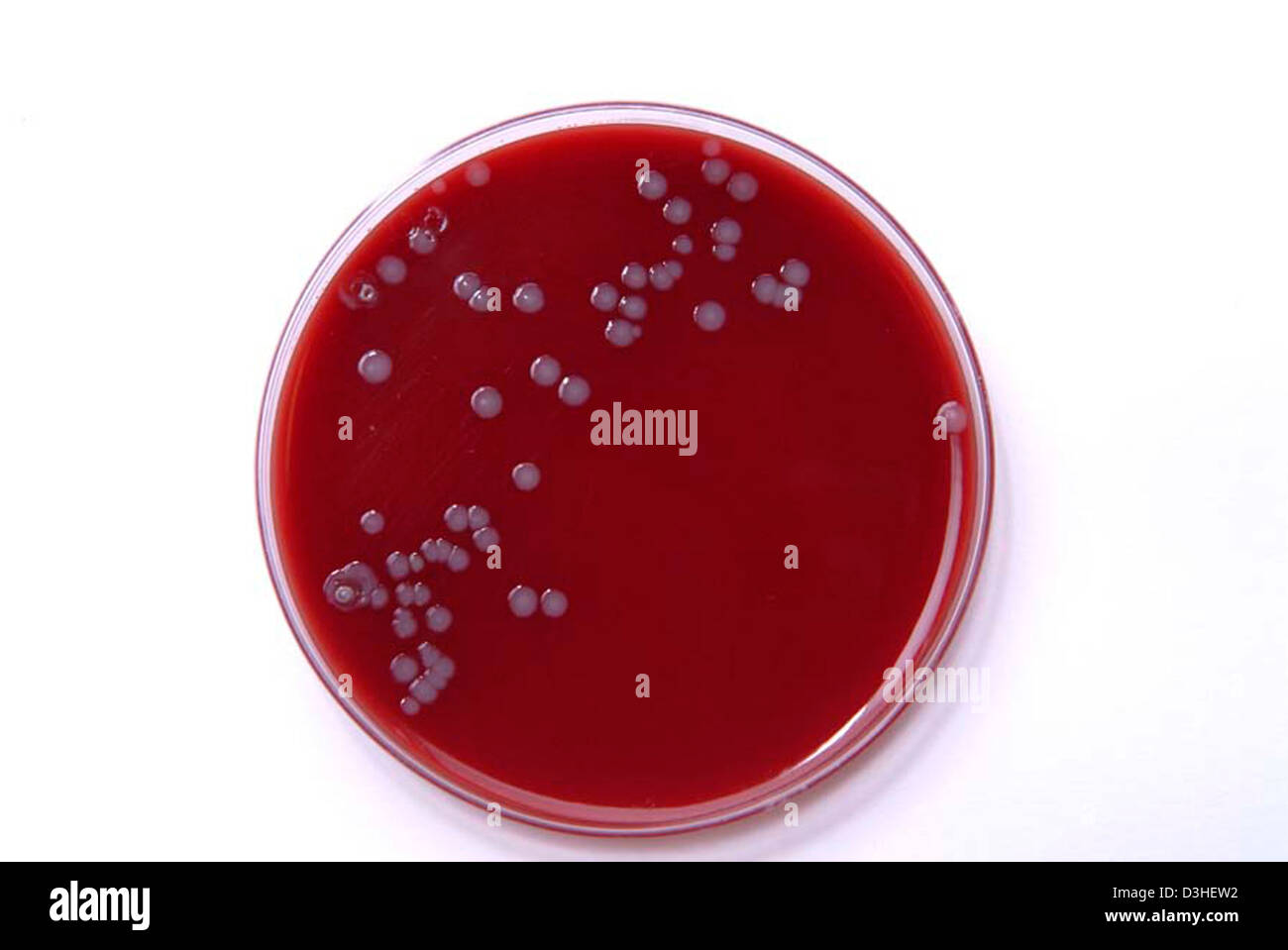 Listeria agar hi-res stock photography and images - Alamy