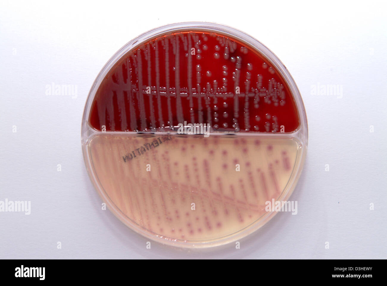 E coli petri hi-res stock photography and images - Alamy