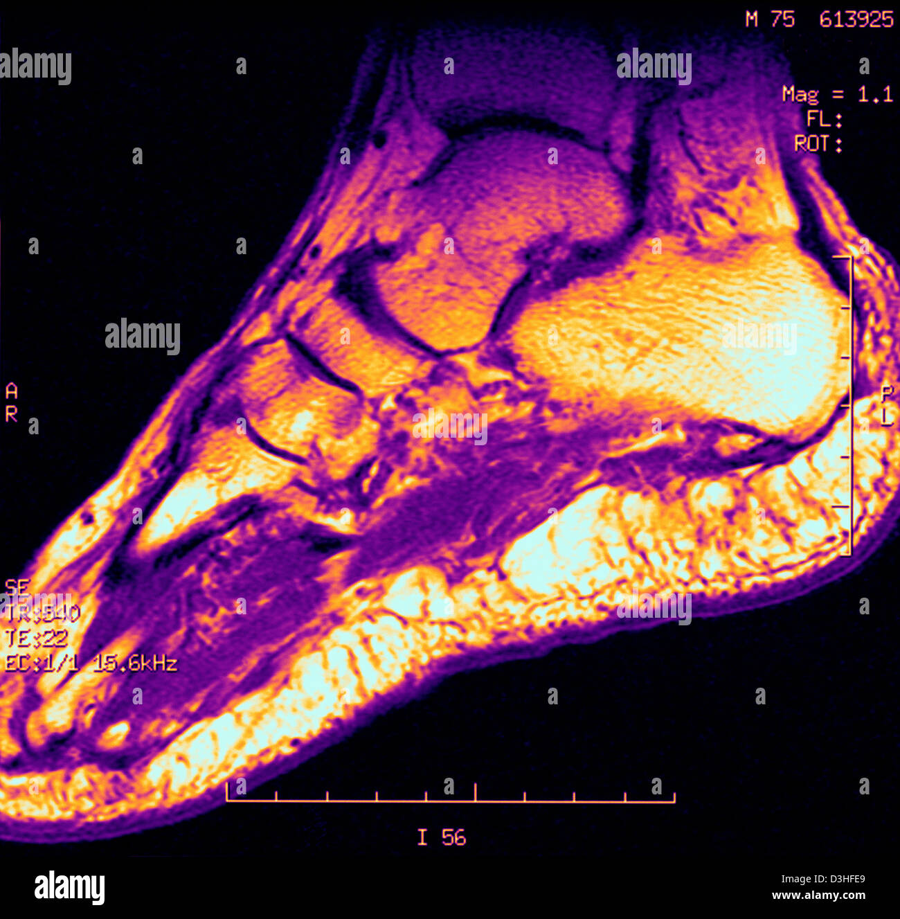 Mri scan feet hi-res stock photography and images - Alamy