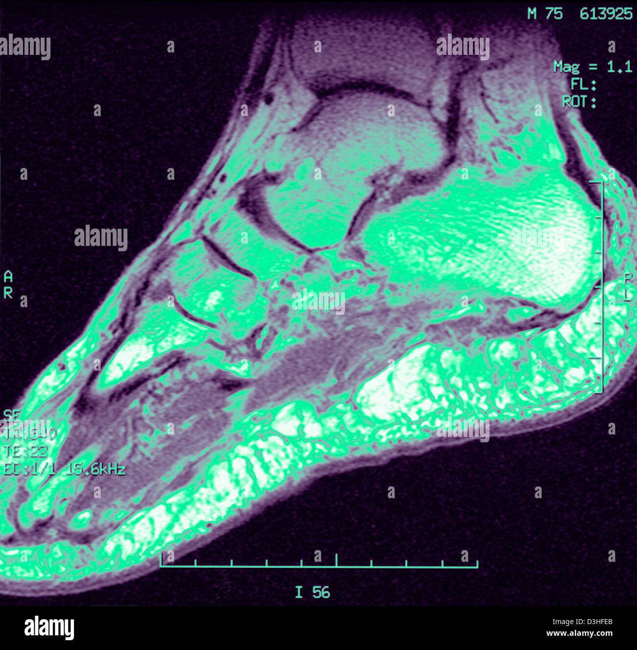 Mri scan feet hi-res stock photography and images - Alamy