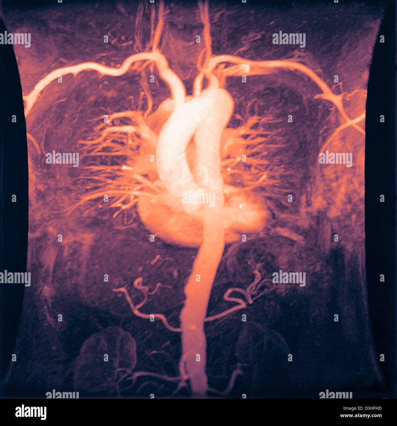 Abdominal aorta examination hi-res stock photography and images - Alamy