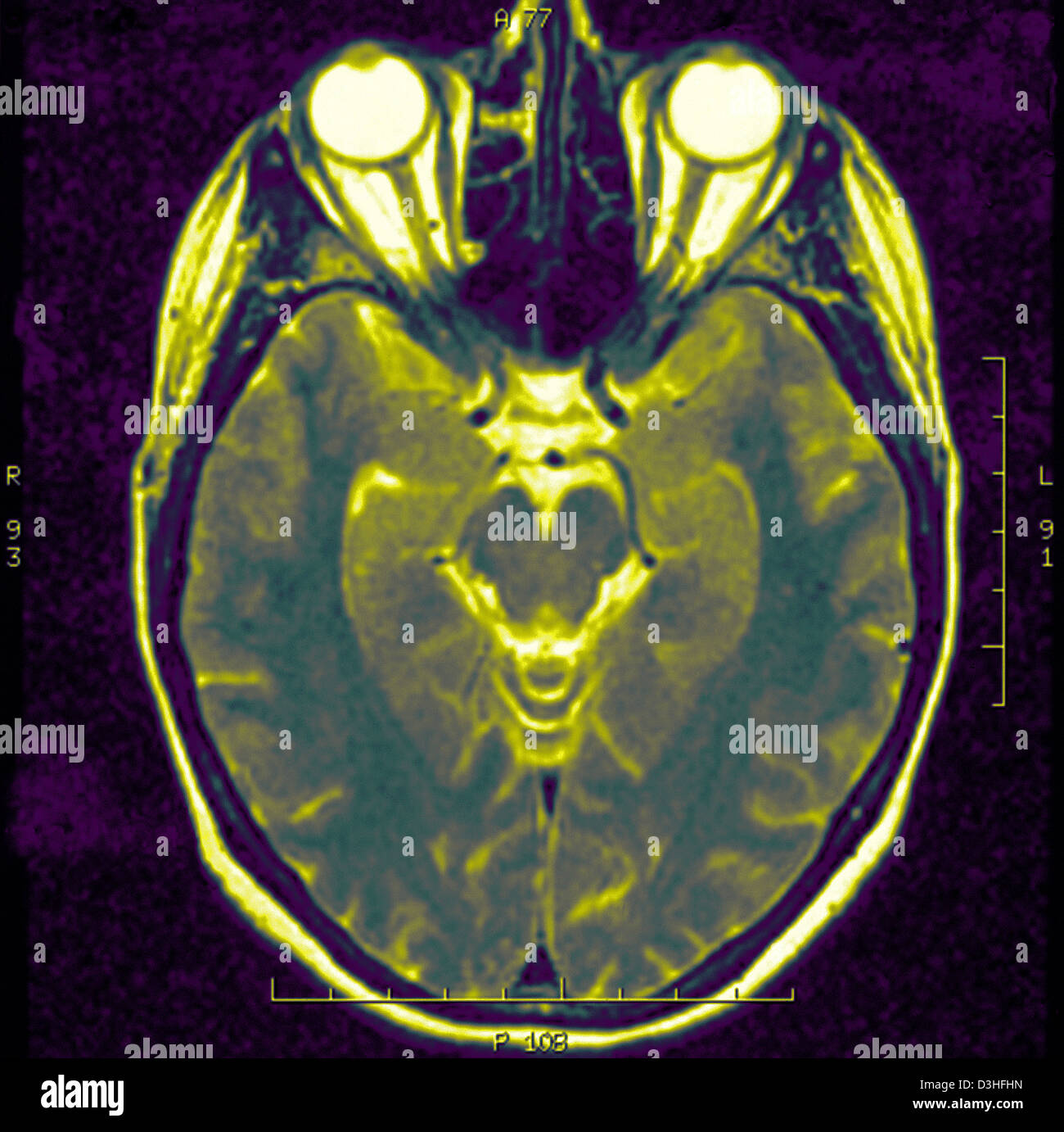 Nmr brain scan hi-res stock photography and images - Alamy