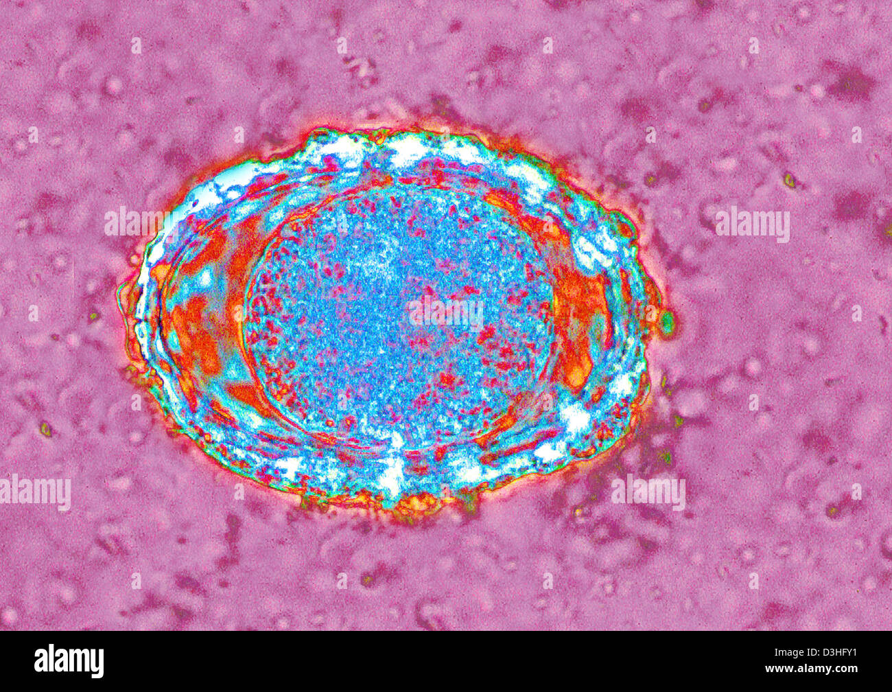 Ascaris worms hi-res stock photography and images - Alamy