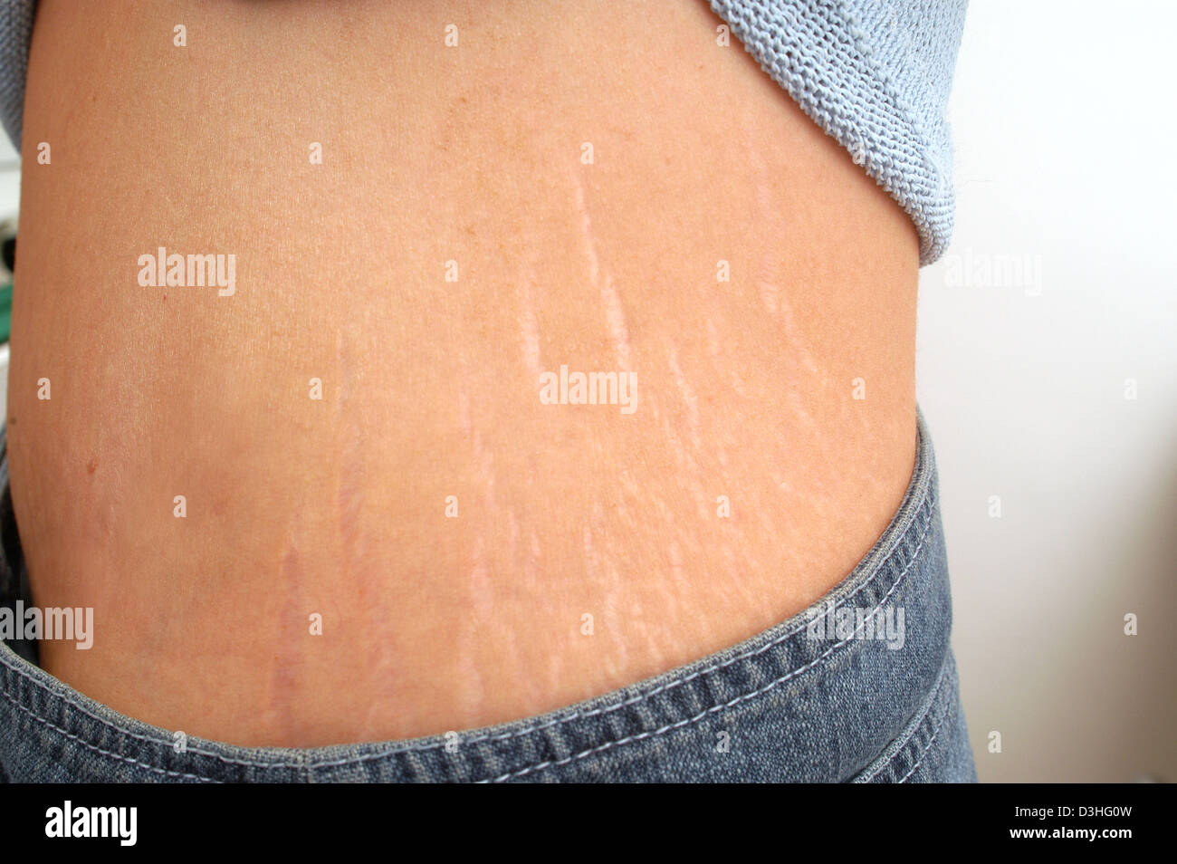 Detailed marks hi-res stock photography and images - Alamy