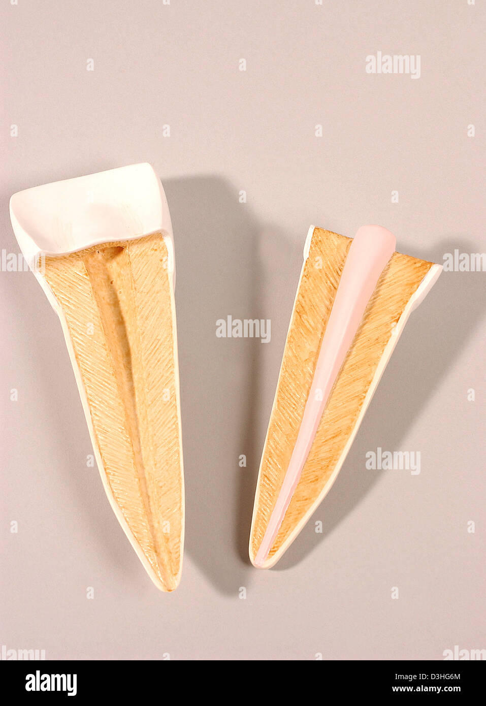 The hollow tooth hi-res stock photography and images - Alamy