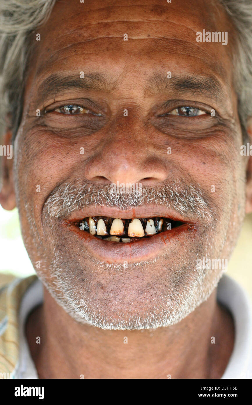 Chewing tobacco teeth hi-res stock photography and images - Alamy